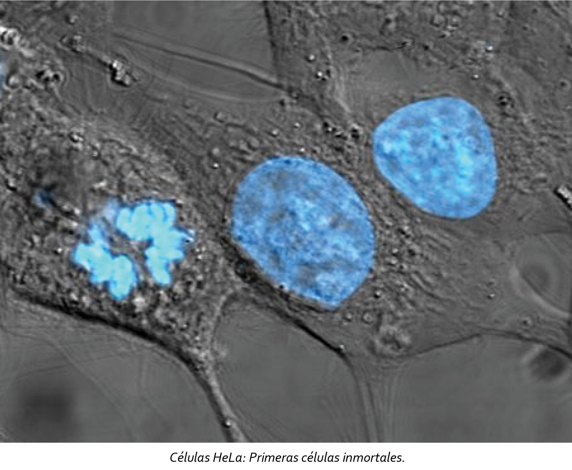 SEMÁFORO DE LAS CÉLULAS MADRE